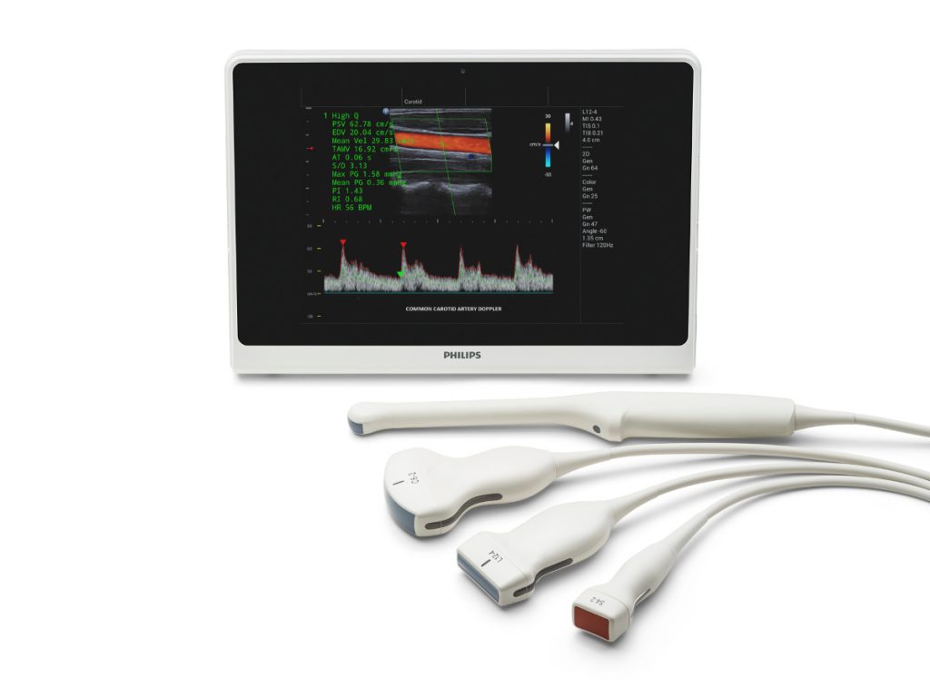 Philips Innosight — купить ультразвуковую систему по выгодной цене