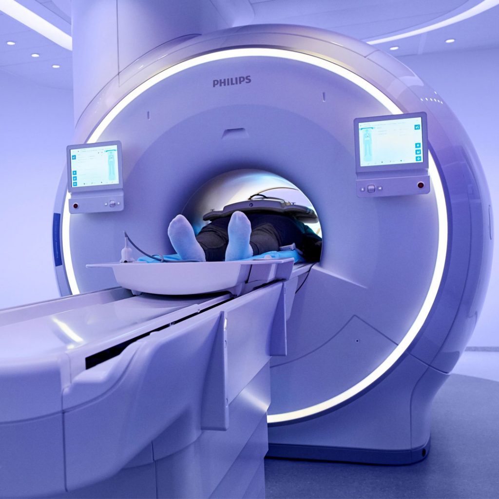 Philips Ingenia Ambition X 1.5T — купить МР-томограф по выгодной цене