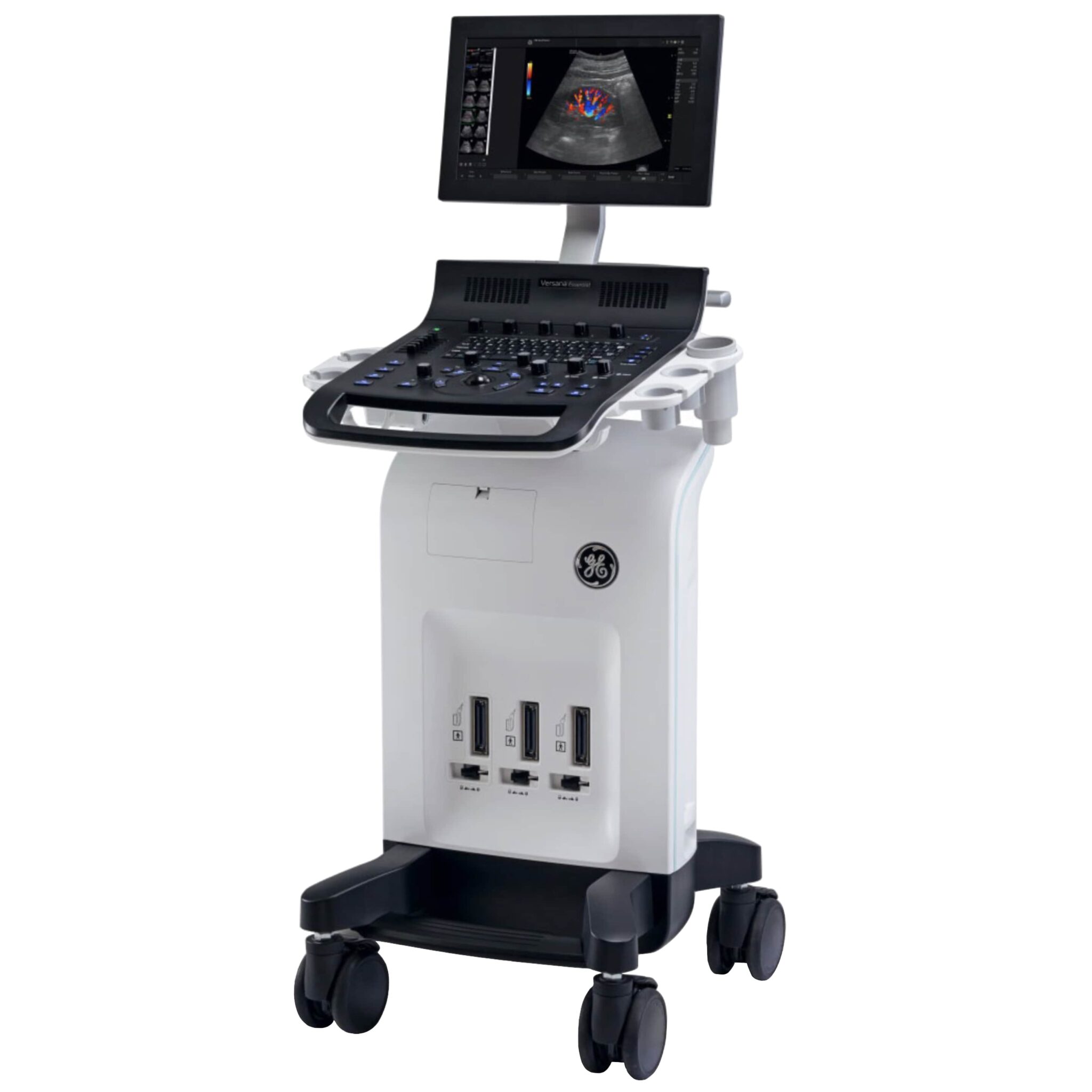 General Electric Versana Essential — купить ультразвуковую систему по ...